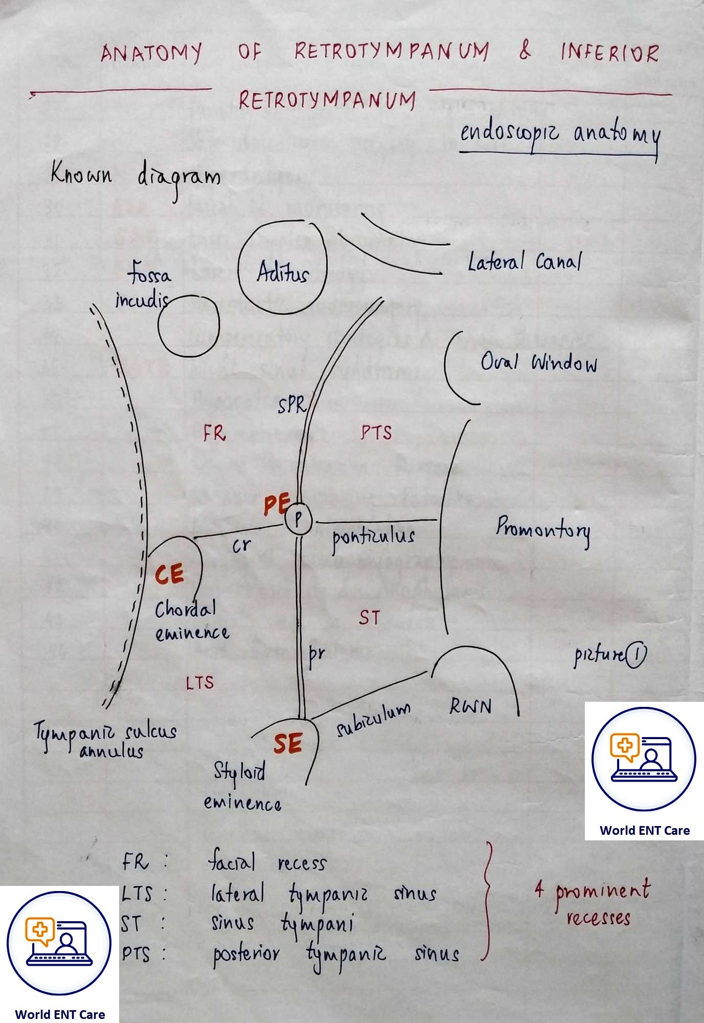 Retrotympanum and Inferior Retrotympanum - World ENT Care